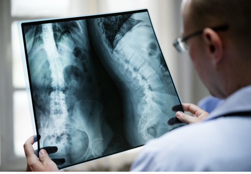 RTG – kiedy rentgen jest niezbędny do postawienia diagnozy?